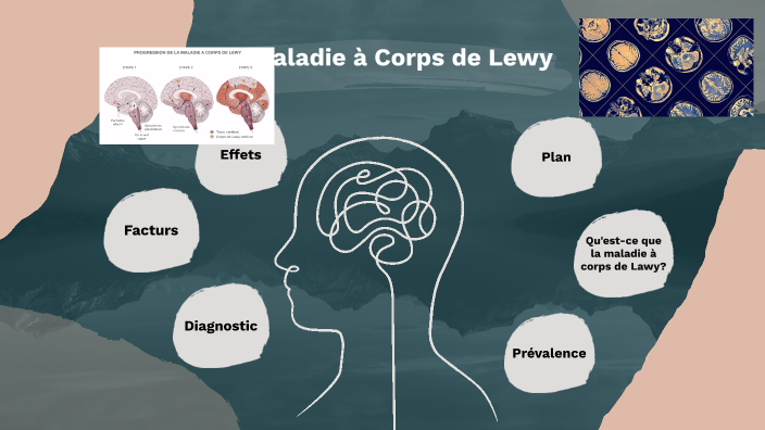La maladie à Corps de Lewy by Meriem El attar on Prezi