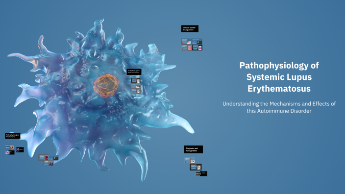 Pathophysiology of Systemic Lupus Erythematosus by Matthew C. Agustin ...