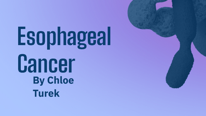Esophagus Cancer Project by Chloe Turek on Prezi