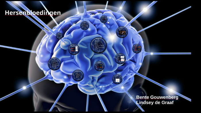 Hersenbloedingen by lindsey . on Prezi