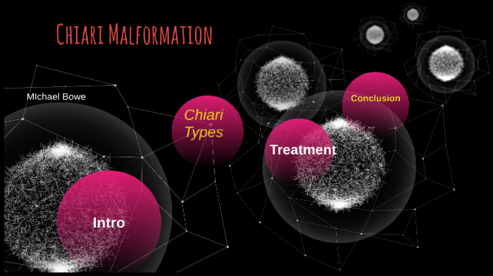 Chari Malformation by michael bowe on Prezi