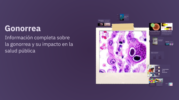 Gonorrea by Melissa Pantoja Damas on Prezi