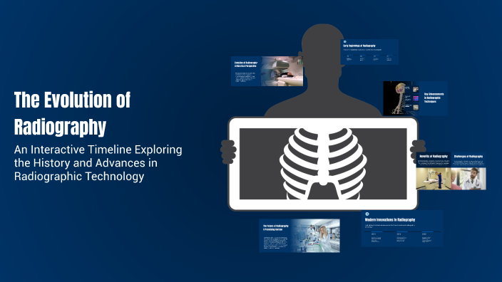 The Evolution of Radiography by olivie kitzman on Prezi