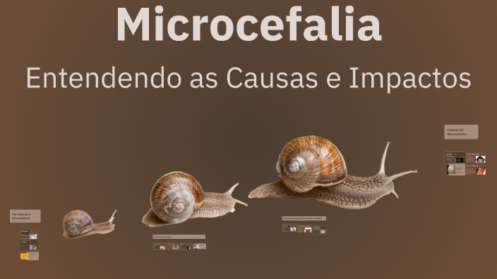 Microcefalia by Mari Santos on Prezi