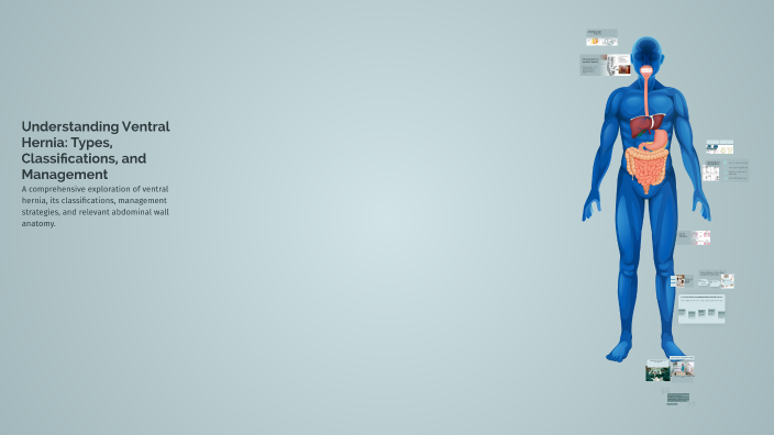 Understanding Ventral Hernia: Types, Classifications, and Management by Sumit Kumar on Prezi