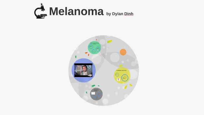 Melanoma by Dylan Dinh on Prezi