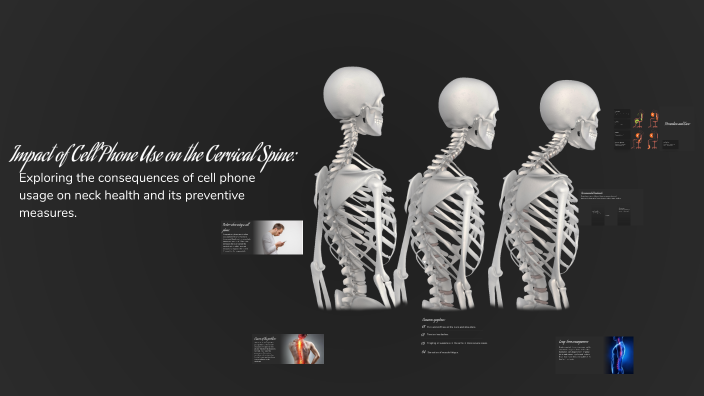 Impact of Cell Phone Use on the Cervical Spine by Miguel Melo on Prezi