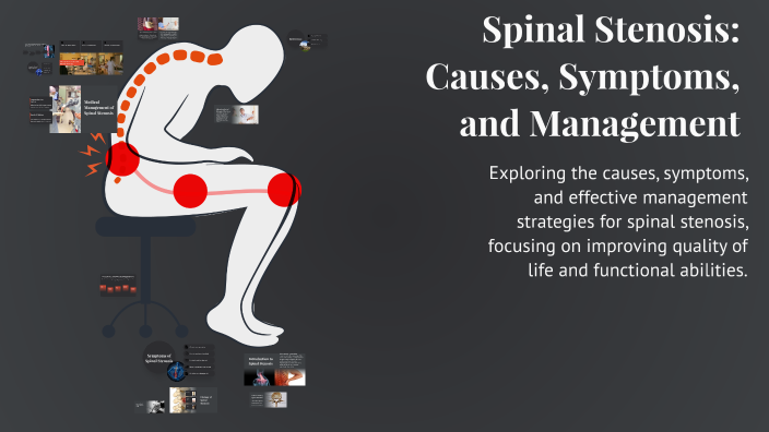Understanding Spinal Stenosis: Causes, Symptoms, and Management by ...