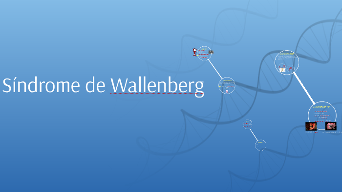 Síndrome de Wallenberg by pepa sisi on Prezi