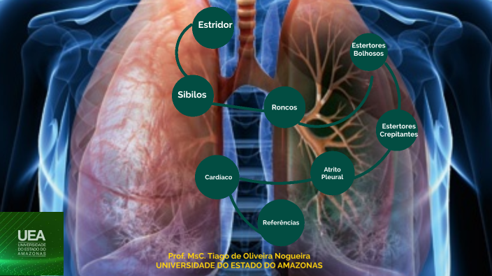 Ruídos Adventícios by Tiago de Oliveira Nogueira on Prezi