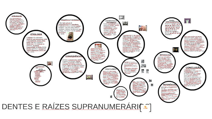 Dentes e Raízes Supranumerários by Luiz Rafael Carvalho Cedraz on Prezi