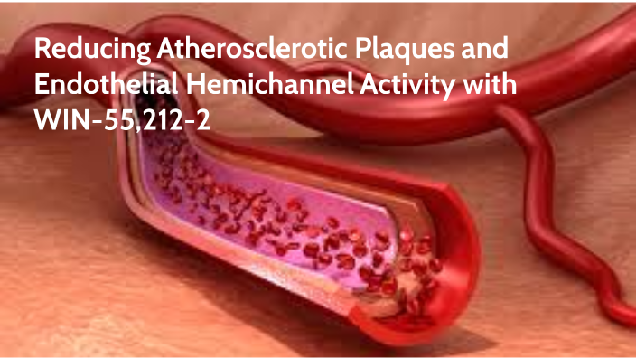 Endothelial Hemichannel Activity by syd bhav on Prezi