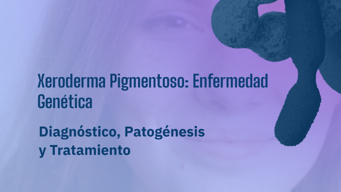 Xeroderma Pigmentoso: Enfermedad Genética by Steisy Córdoba Mora on Prezi