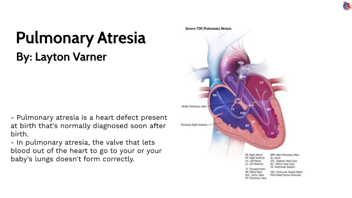 Pulmonary Atresia by Layton Varner on Prezi