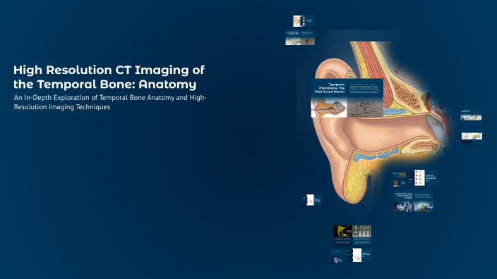 High Resolution CT Imaging of the Temporal Bone: Anatomy by kidus ...