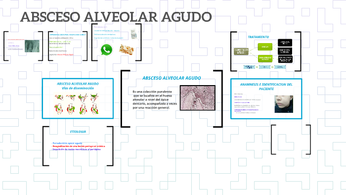 ABSCESO ALVEOLAR AGUDO by Sophia Torres on Prezi