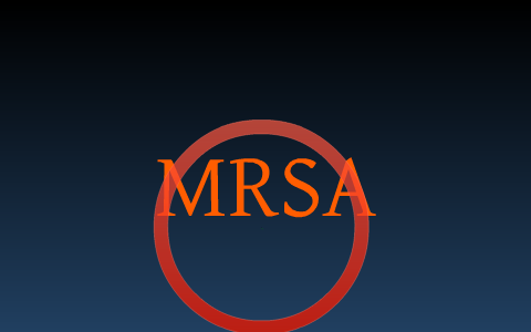 MRSA (staph) by James Camp on Prezi