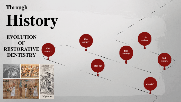 Evolution of restorative dentistry by roaya mohamed on Prezi