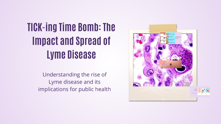 TICK-ing Time Bomb: The Impact and Spread of Lyme Disease by CHI N on Prezi