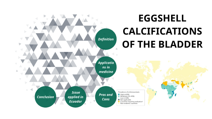 EGGSHELL CALCIFICATIONS OF THE BLADDER by Dévora Ruiz on Prezi