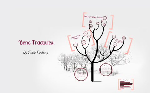 Bone Fractures by Katie Dockery on Prezi