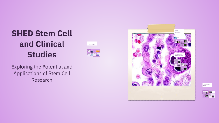 SHED Stem Cell and Clinical Studies by Hamza Amro on Prezi