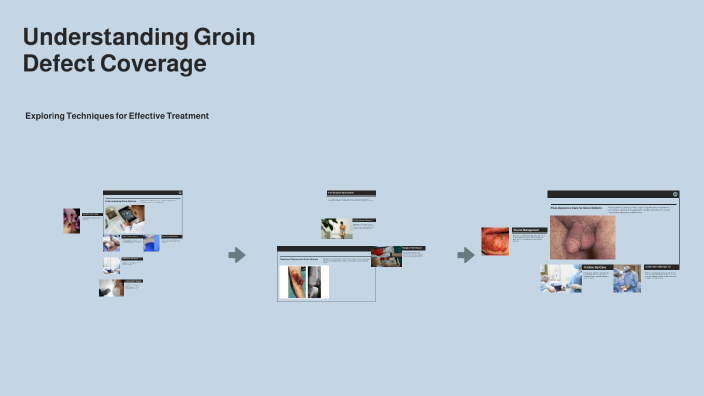 Understanding Groin Defect Coverage by abdelrahman salama on Prezi