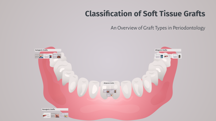 Classification of Soft Tissue Grafts by irem şahin on Prezi