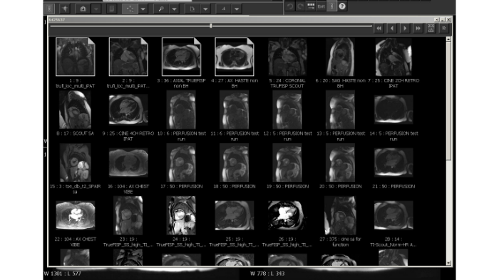 Cardiac MRI Sequences by Pal Suranyi on Prezi