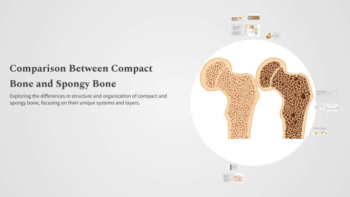 Comparison Between Compact Bone and Spongy Bone by Habiba Diaa edeen on ...