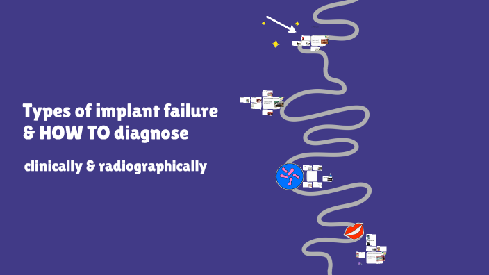 Understanding Implant Failures by mariam hatem on Prezi