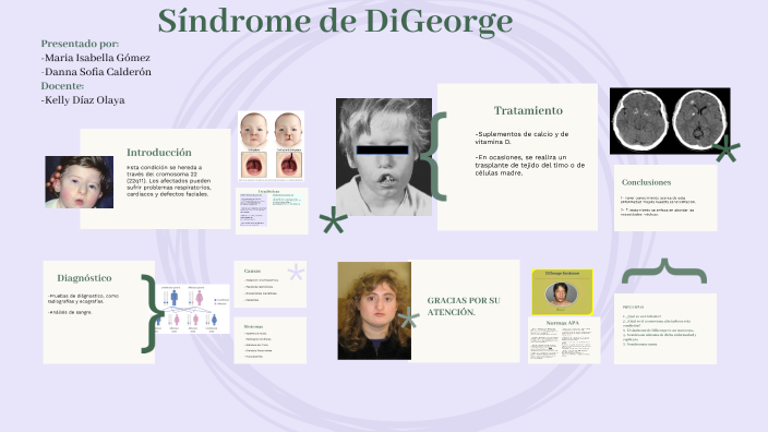 Sindrome de DiGeorge by Sofia on Prezi