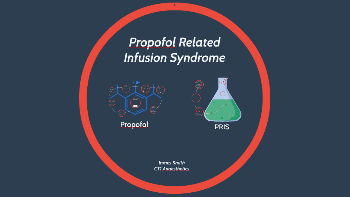 Propofol Infusion Syndrome by James Smith on Prezi