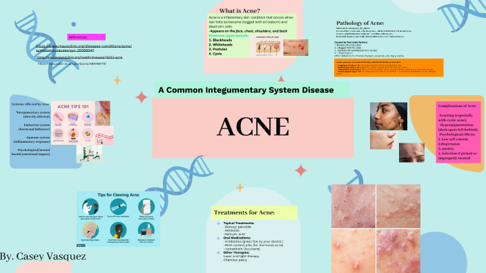 Integumentary system ideas: Acne by Casey Vasquez on Prezi