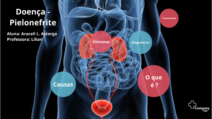 PIELONEFRITE by Araceli Astorga on Prezi