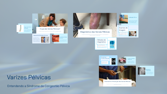 Varizes Pélvicas by José Augusto Ribeiro on Prezi