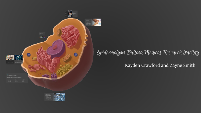 Understanding Epidermolysis Bullosa by Zayne Smith on Prezi