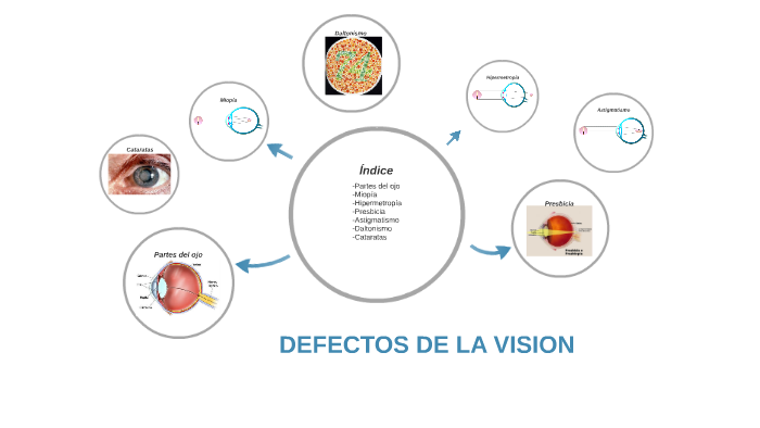 DEFECTOS DE LA VISION by Belén Morgado Jiménez on Prezi