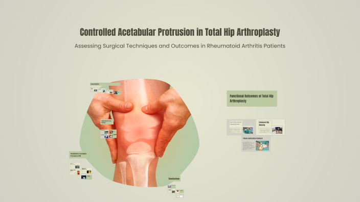 Controlled Acetabular Protrusion in Total Hip Arthroplasty by Dario ...