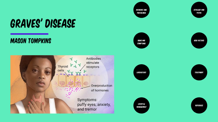 Graves Disease Knowledge Map by Mason Tompkins on Prezi