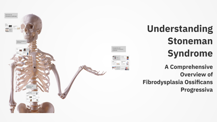 Understanding Stoneman Syndrome by Aaron Alas on Prezi