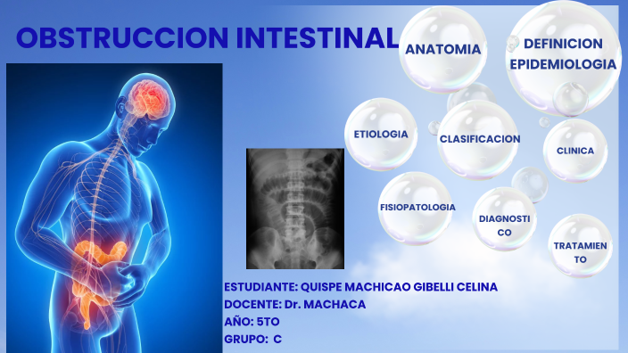OBSTRUCCION INTESTINAL by Pamela Quispe Ramos on Prezi