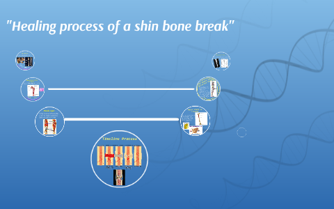 Healing process of a shin bone break by Micah Davis on Prezi