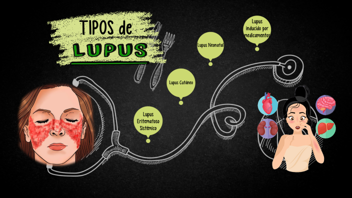 Tipos de LUPUS by Andrea Limaymanta on Prezi