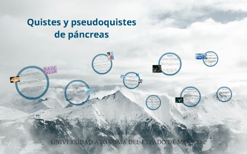 Quistes y Pseudoquistes pancreaticos by Steve Atom Sneider on Prezi