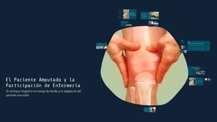 El Paciente Amputado y la Participación de Enfermería by Ari Galvan on ...