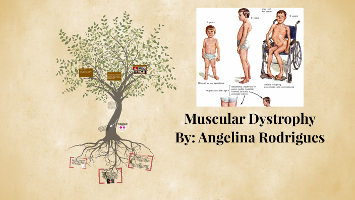 Muscular Dystrophy By: Angelina Rodrigues by Angelina Rodrigues on Prezi
