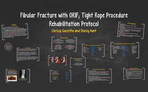 Fibular Fracture with ORIF; Tight Rope Procedure Rehabilitat by Shelby ...