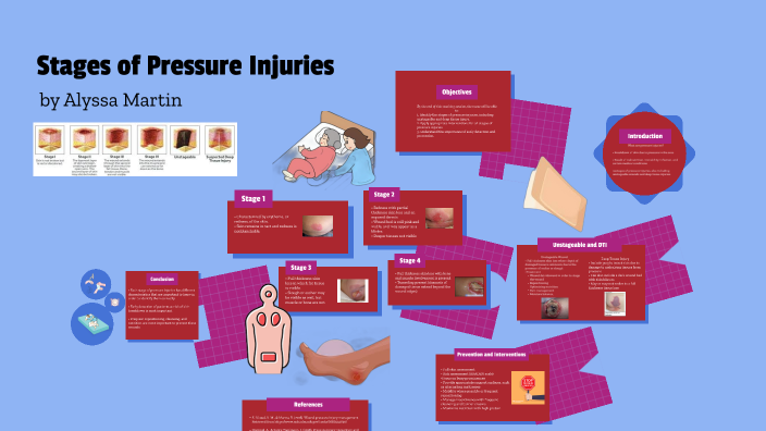 Stages of Pressure Injuries by Alyssa Martin on Prezi