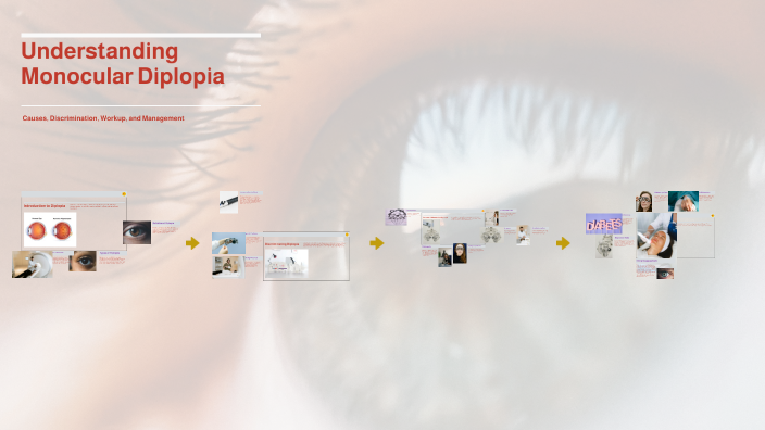 Understanding Monocular Diplopia by David Morcos on Prezi